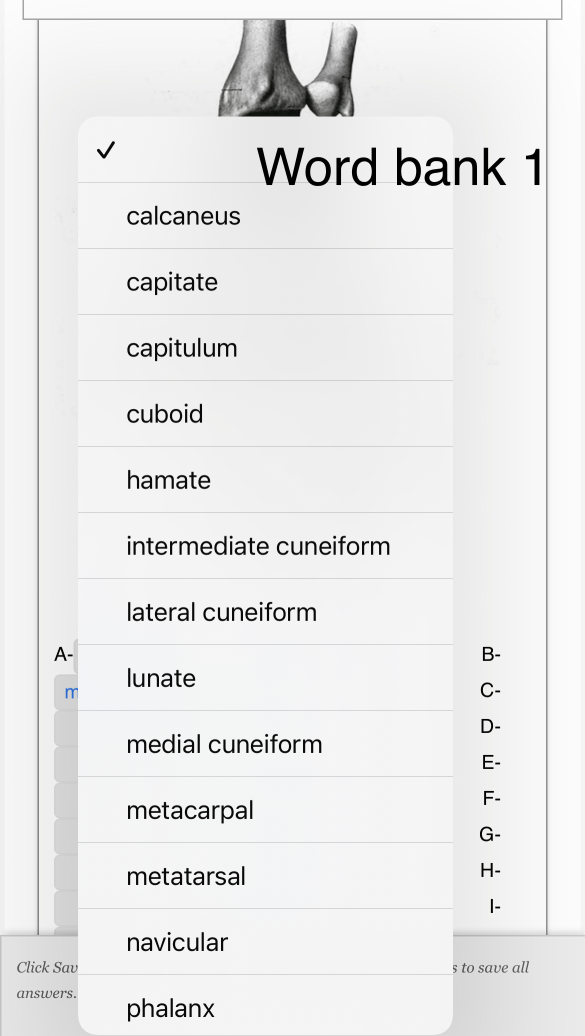 Solved Identify the indicated bones Word bank 1 calcaneus | Chegg.com