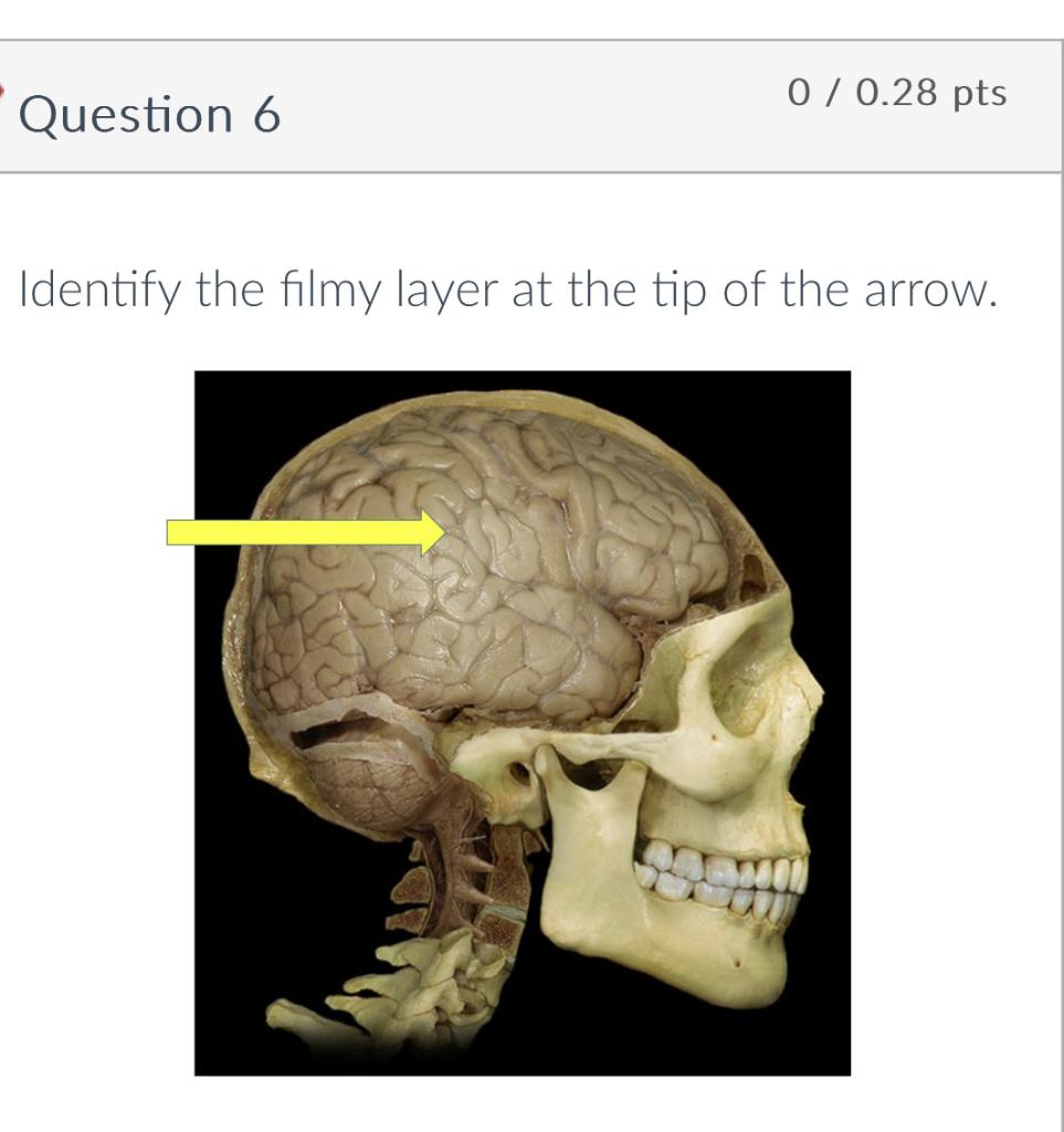 Identify the filmy layer at the tip of the arrow. | Chegg.com