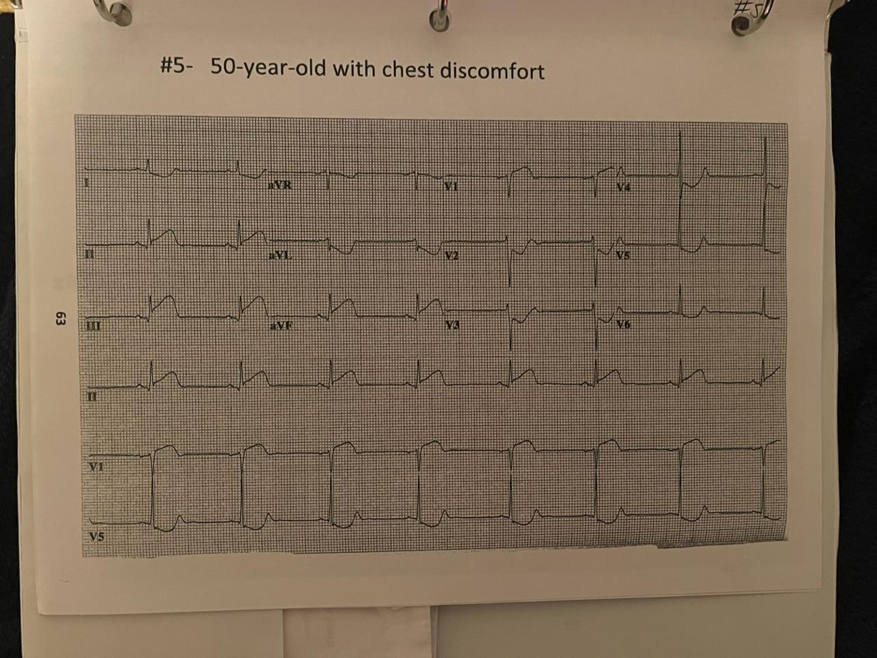 1. rhythm regular or irregular 2. determine the heart | Chegg.com
