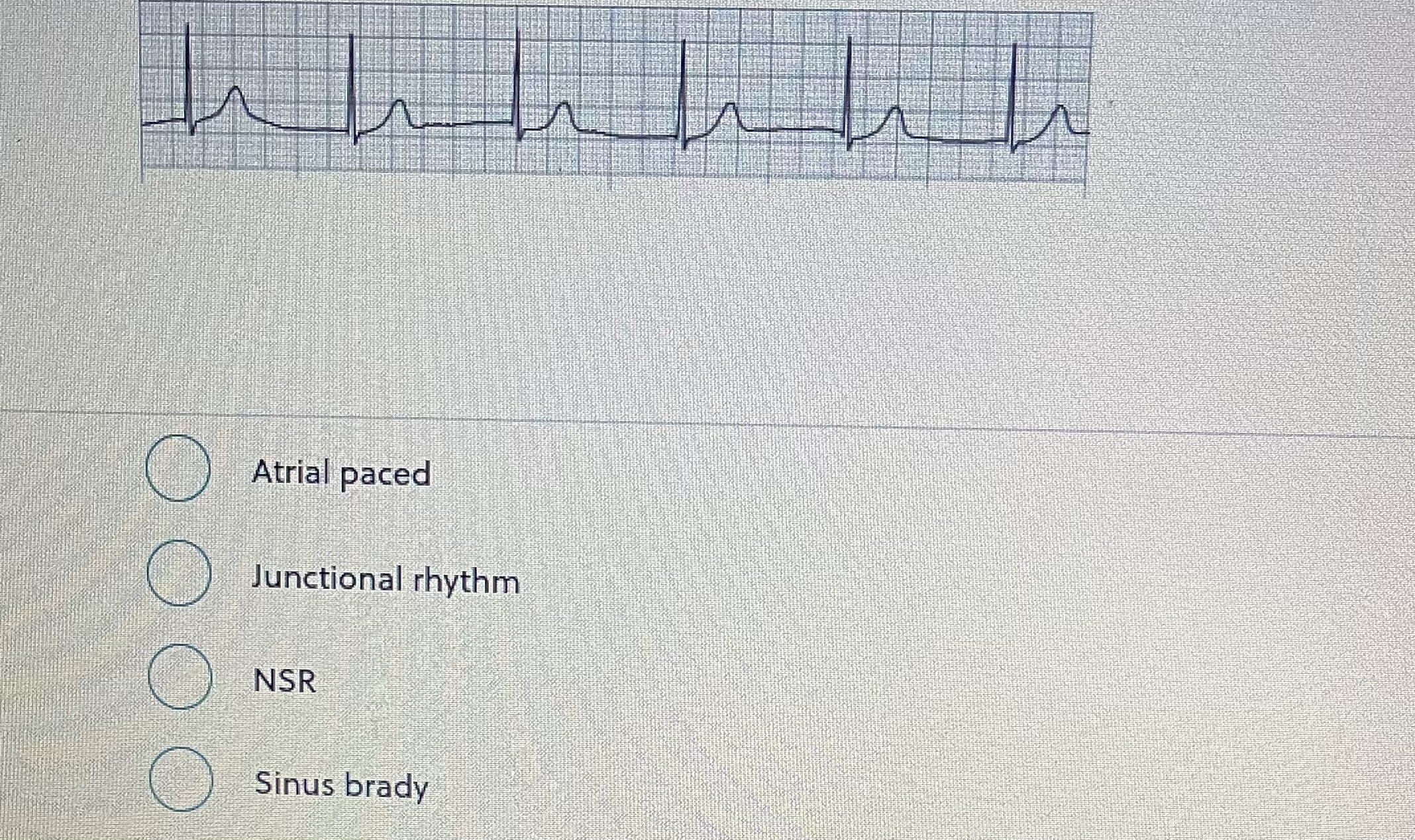 Solved Atrial paced Junctional rhythm NSR Sinus brady | Chegg.com