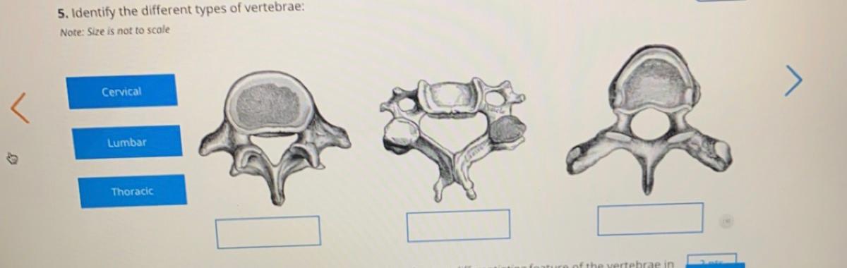 Solved 5. Identify the different types of vertebrae: Note: | Chegg.com Solved 5. Identify the different types of vertebrae: Note: | Chegg.com