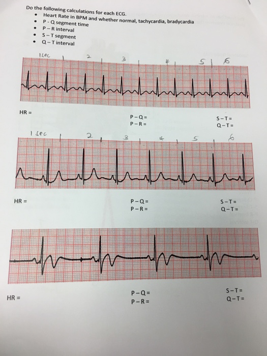 Solved Do the following calculations for each ECG. .He . P-Q | Chegg.com