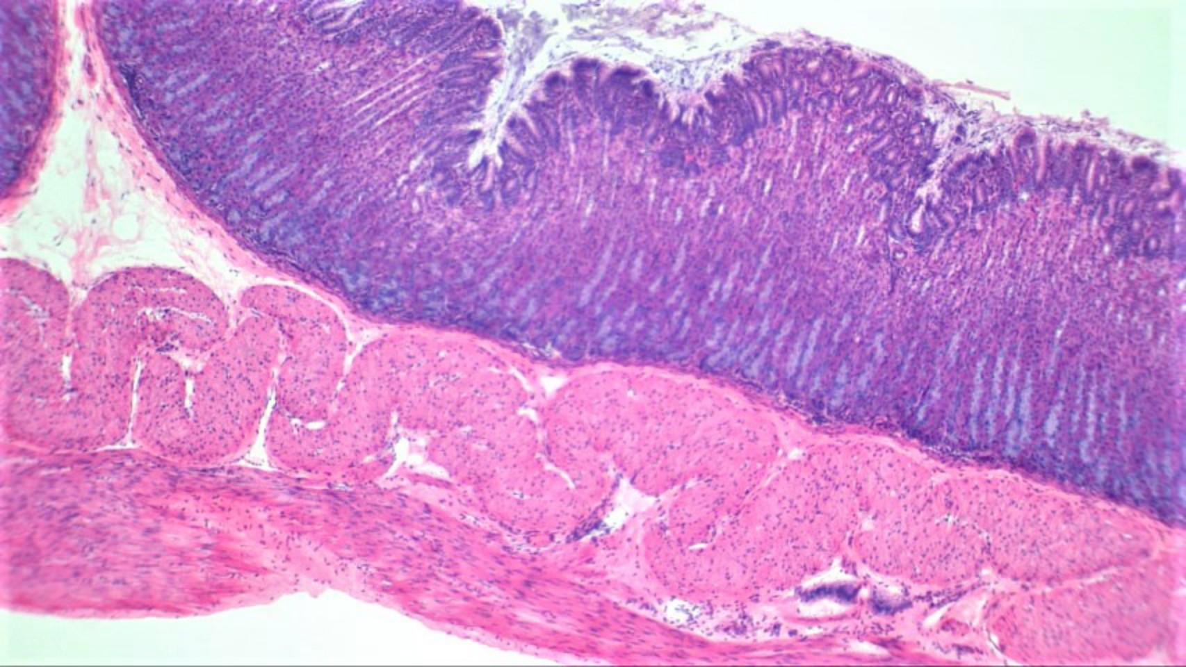 Solved This is a stomach slide under the microscope. Please | Chegg.com