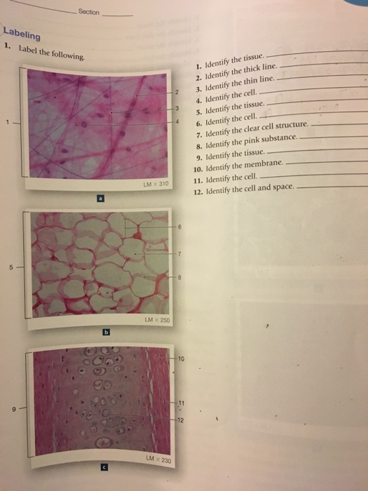 Solved Label the following about connective tissues. | Chegg.com Solved Label the following about connective tissues. | Chegg.com