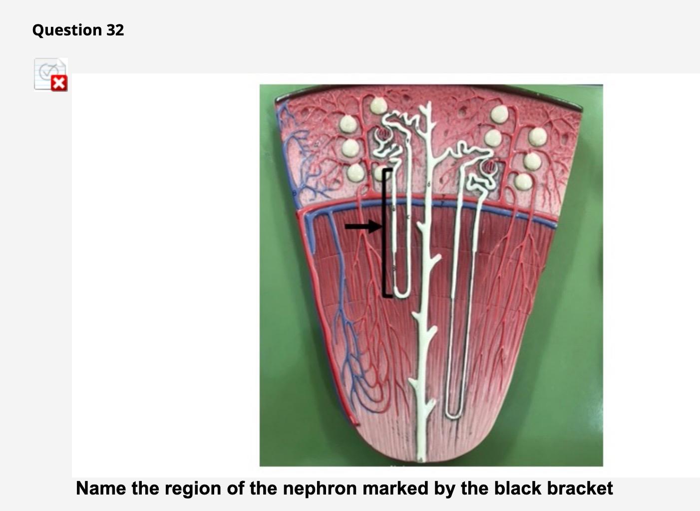 Solved Question 32 x Name the region of the nephron marked | Chegg.com