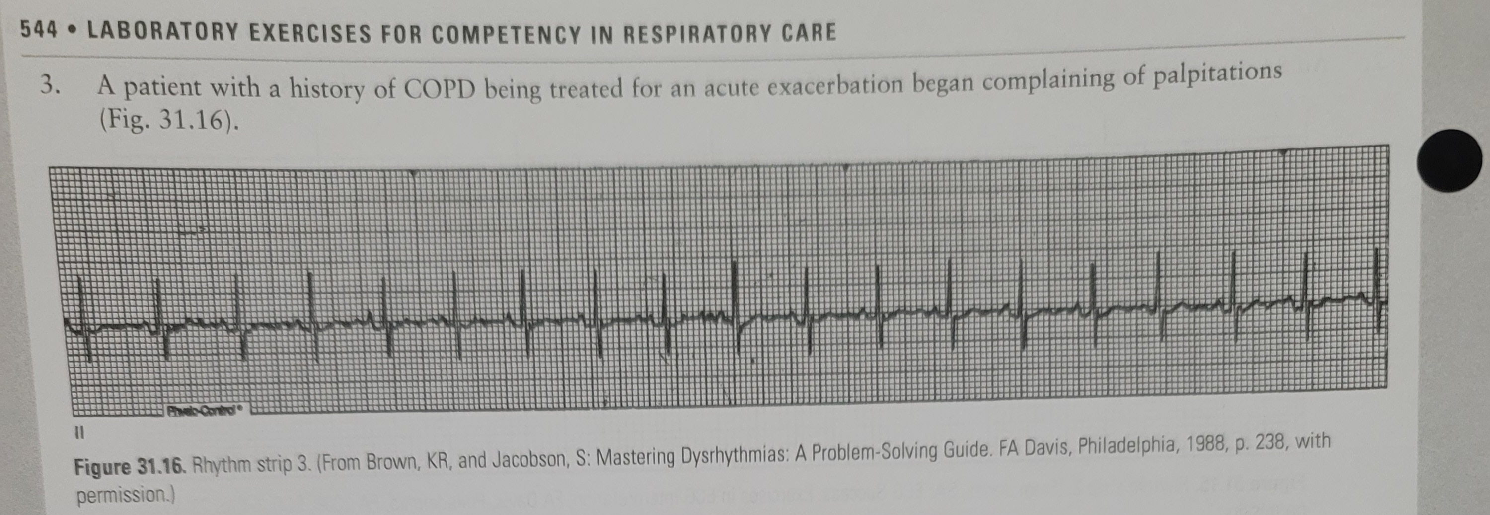 Solved A) Rate:B) Rhythm: regular or irregular?C) P waves: | Chegg.com