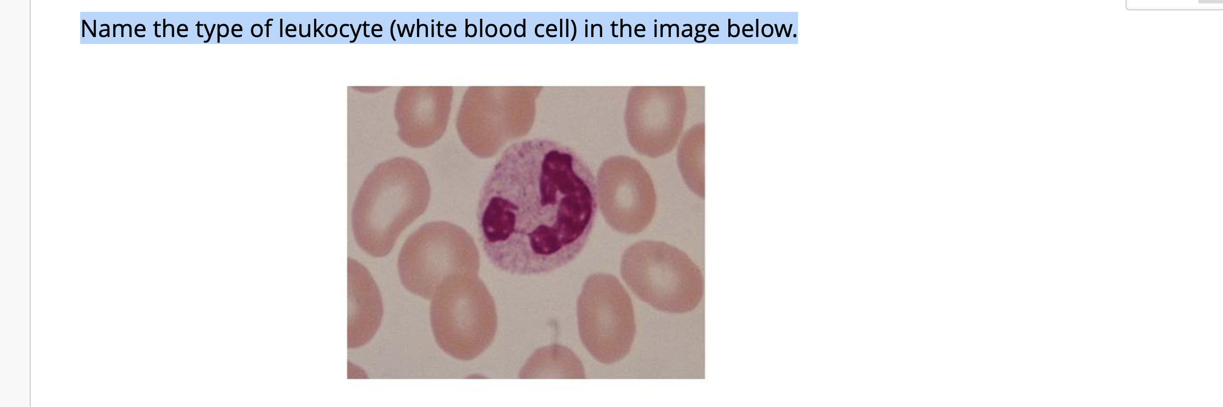 Solved Name the type of leukocyte (white blood cell) in the | Chegg.com