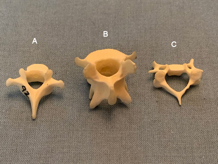 Solved Compare the three vertebrae in the picture below from | Chegg.com