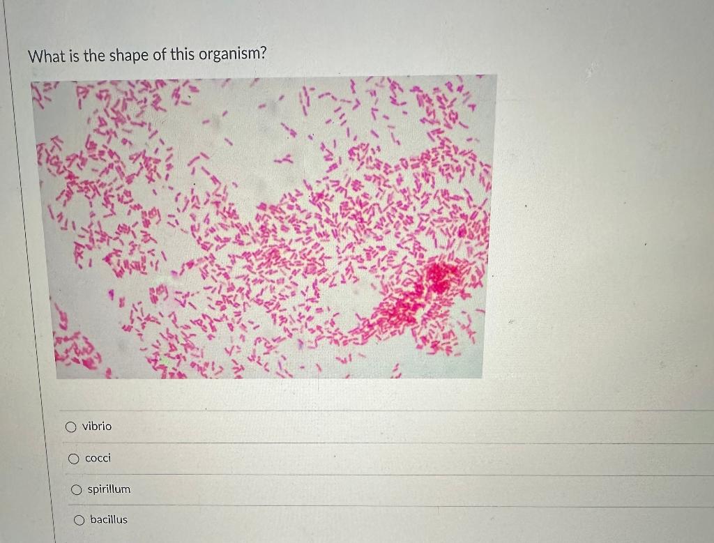 Solved If you were to perform the indole test with the SIM | Chegg.com