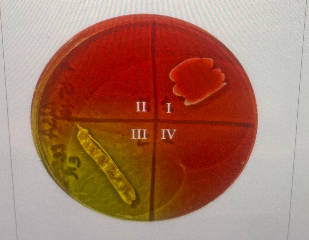 Solved Mannitol salt agar is selective for gram positive | Chegg.com