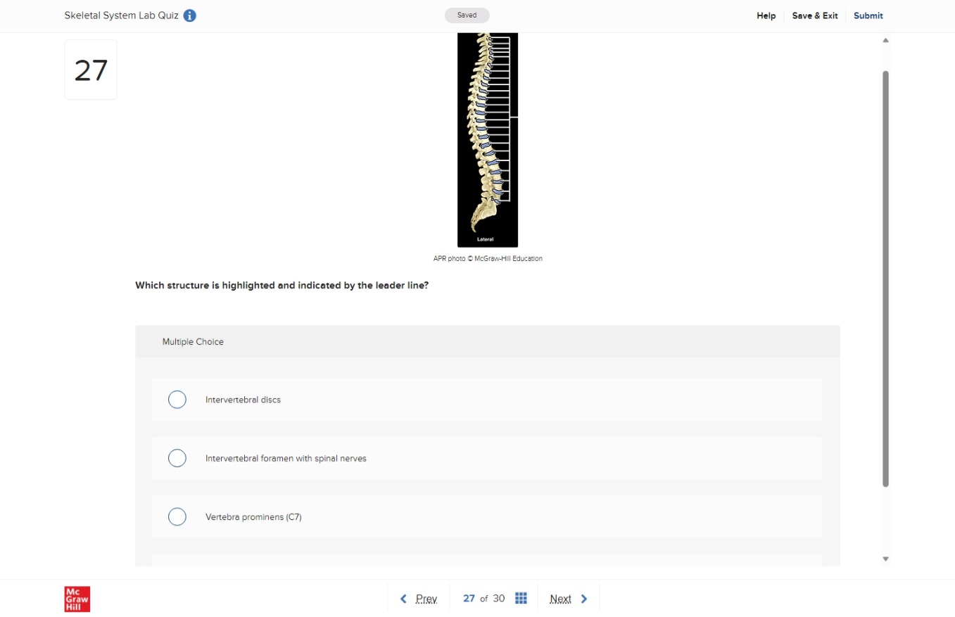 Skeletal System Lab Quiz (iSavedHelpSave & | Chegg.com Skeletal System Lab Quiz (iSavedHelpSave & | Chegg.com