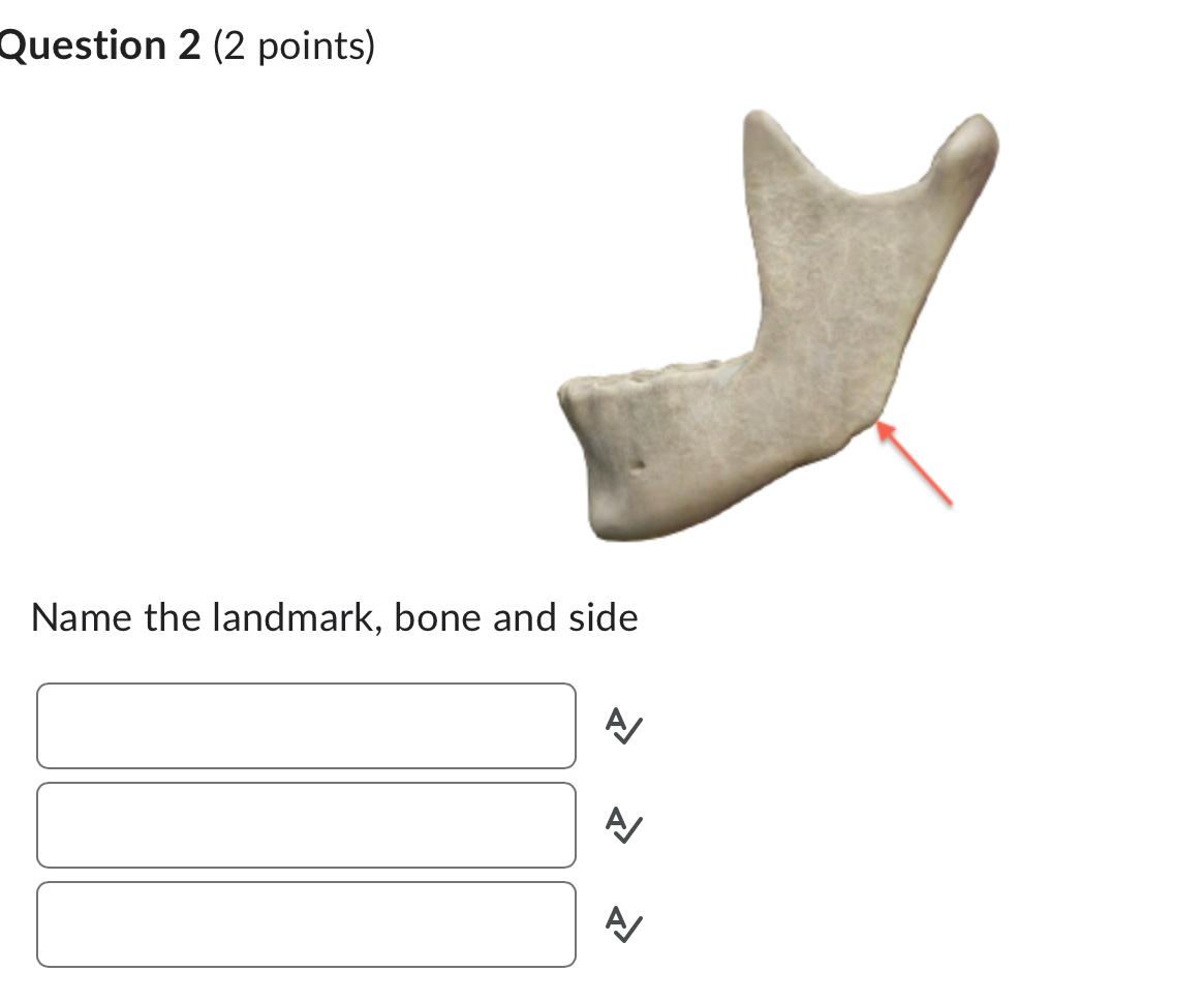 Solved Question 2 (2 points) Name the landmark, bone and | Chegg.com