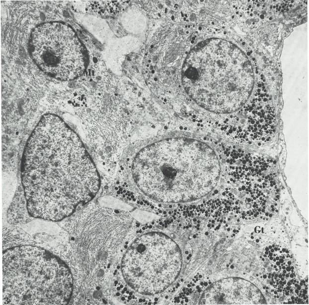 Vesicles Micrograph