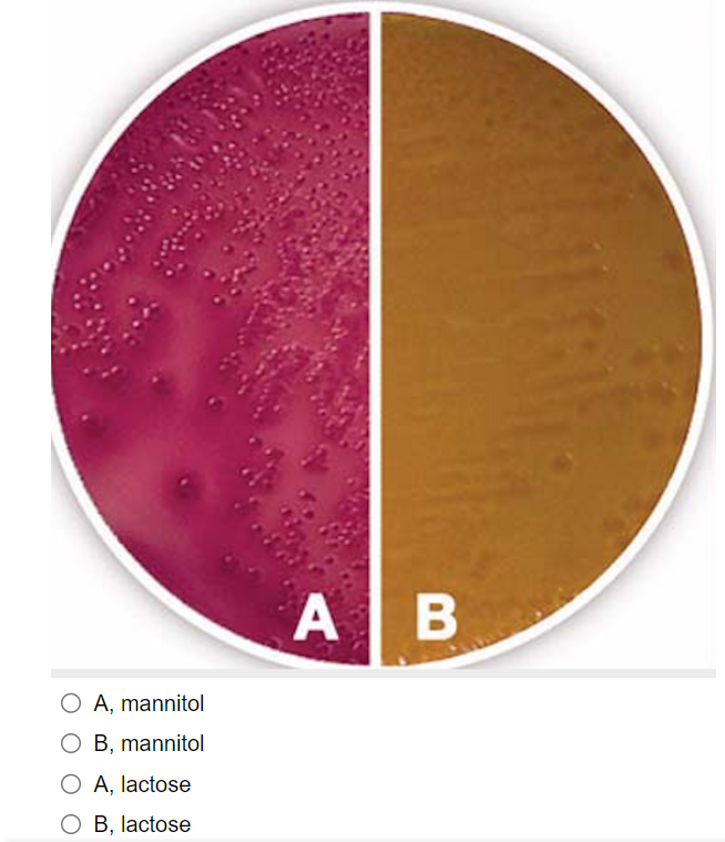 Solved An organism streaked out on HE agar appeared as | Chegg.com