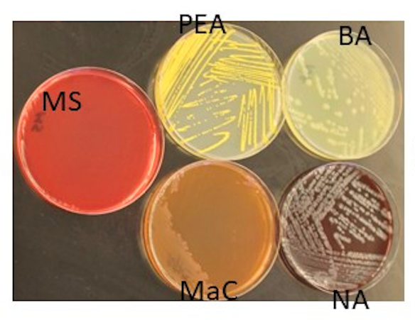 Solved Describe the colonies seen on Blood Agar Plate Mac | Chegg.com