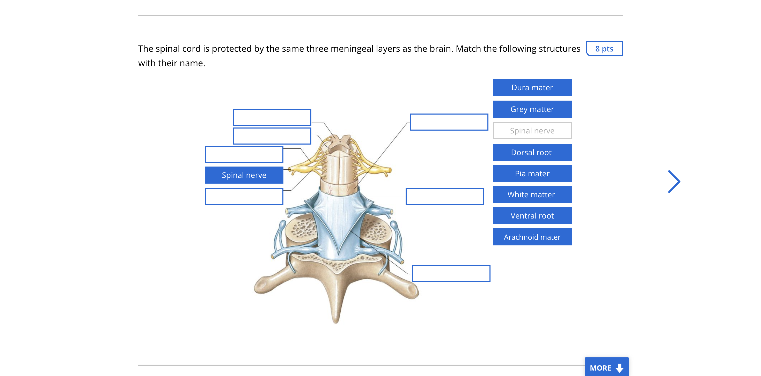 Solved The spinal cord is protected by the same three | Chegg.com