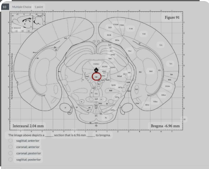 Solved 1. ﻿The image above depicts a ____ ﻿section that is | Chegg.com