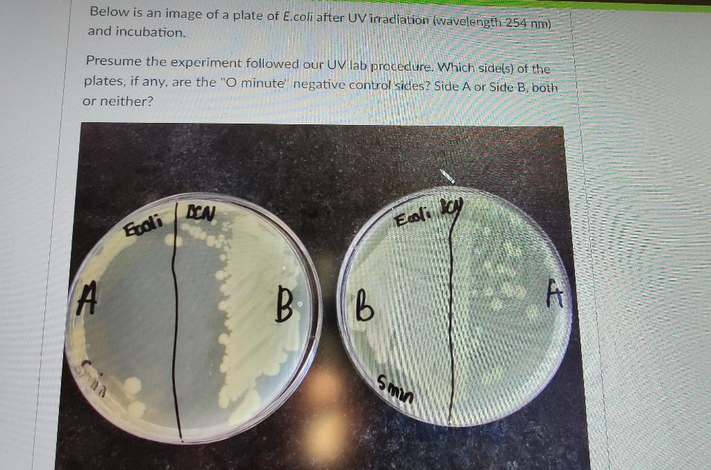 Solved Below is an image of a plate of E.coli after UV | Chegg.com