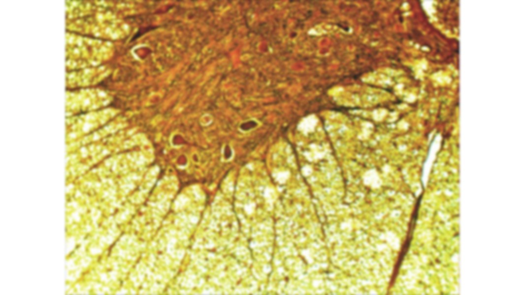 Solved Note: The colors of the tissue (white and gray) have | Chegg.com