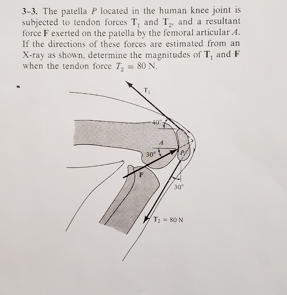 Solved 3-3. The patella P located in the human knee joint is | Chegg.com