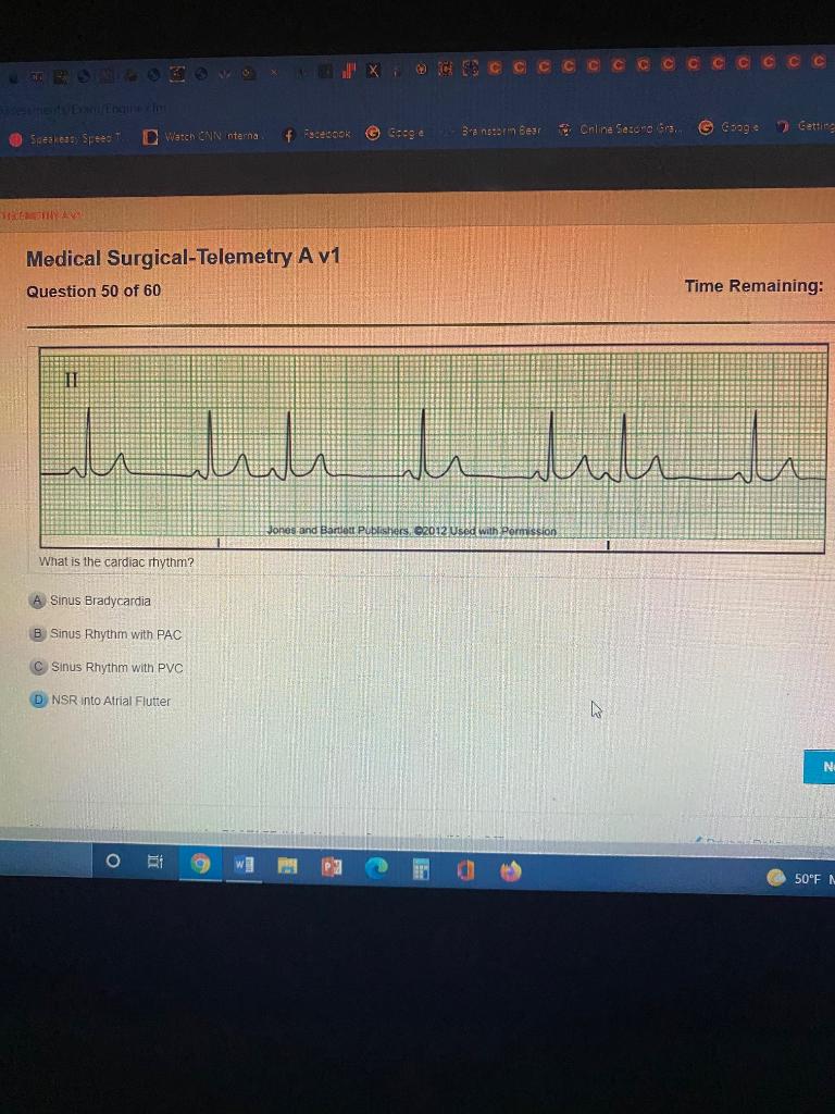 Solved C Medical Surgical-Telemetry A v1 Question 7 of 60 | Chegg.com