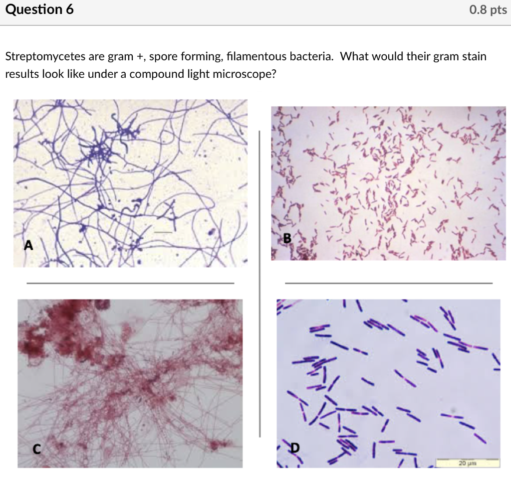 Solved Choose all the TRUE statements regarding the image | Chegg.com