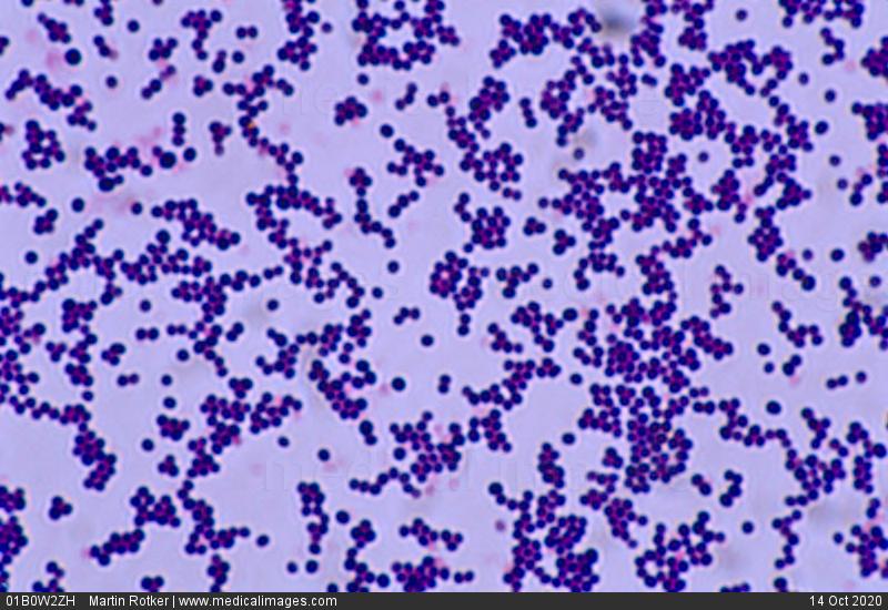 Solved You perform several tests on an unidentified | Chegg.com