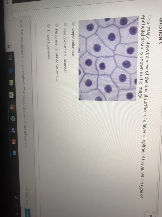 Solved QUESTION 3 This image shows a view of the apical | Chegg.com