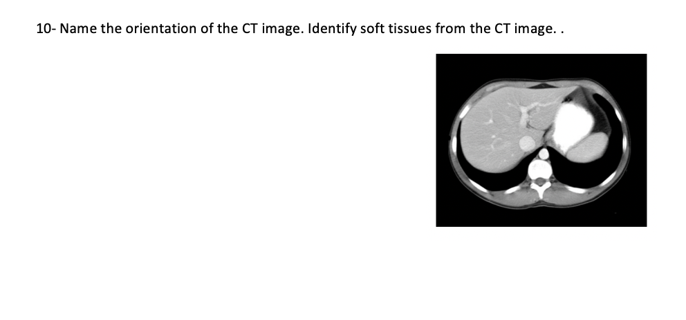 Solved 10- Name the orientation of the CT image. Identify | Chegg.com