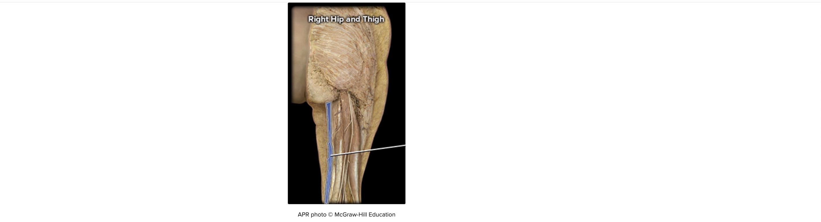 Solved APR photo (c) McGraw-Hill Education Which structure | Chegg.com