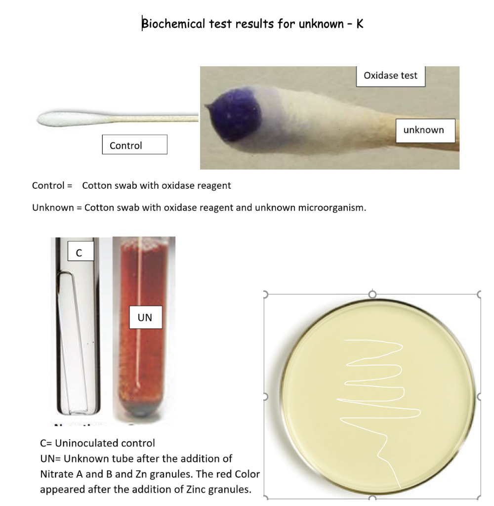 Look at the biochemical test results attached | Chegg.com
