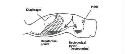Solved Pubis Diaphragm Hepatorenal pouch Rectovesical pouch | Chegg.com