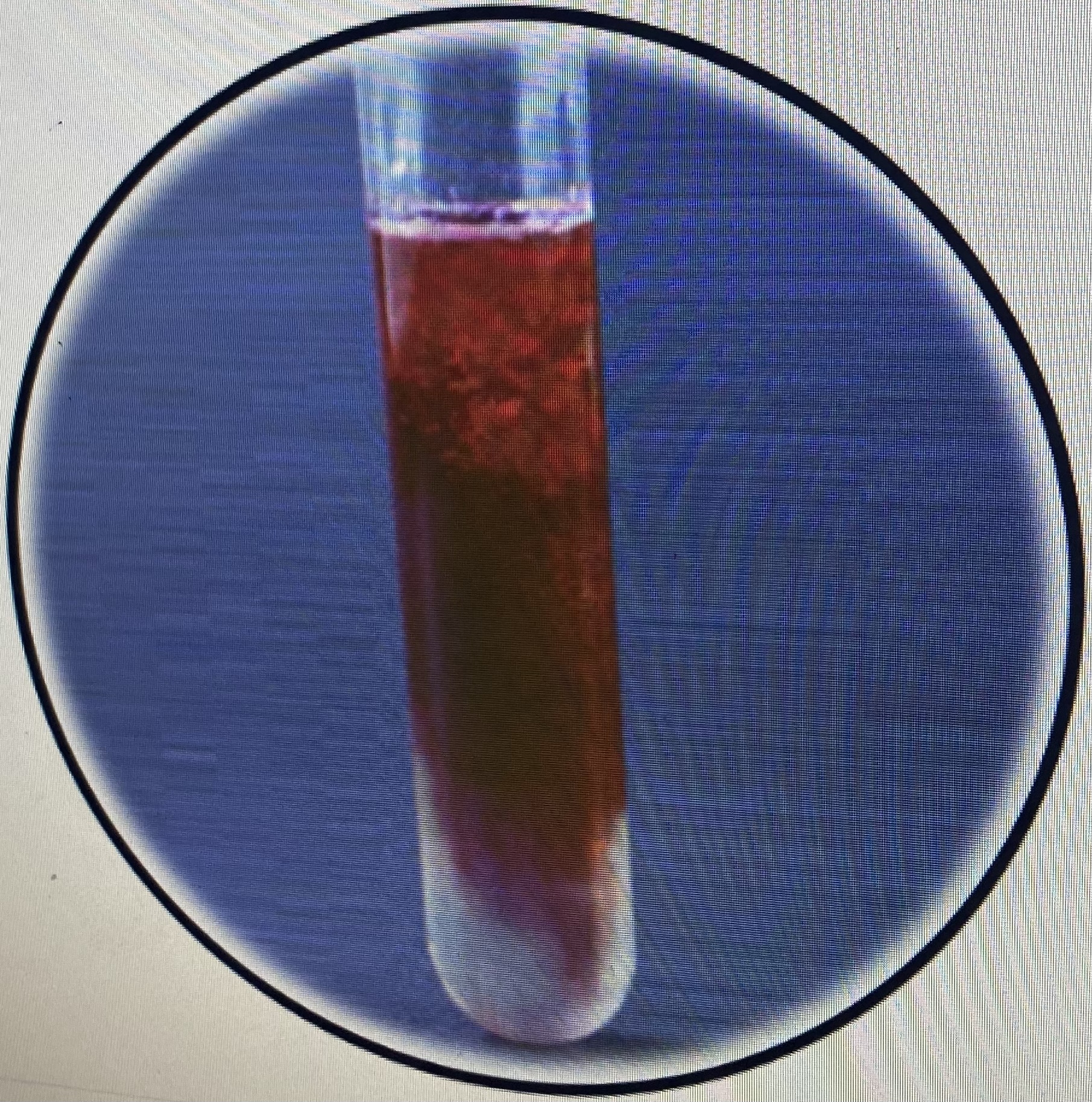 Solved Question 1- An unknown bacterium was inoculated into | Chegg.com