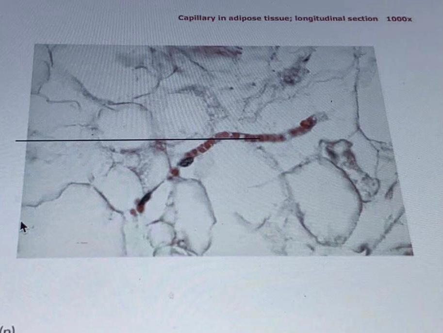 Solved Capillary in adipose tissue; longitudinal section | Chegg.com