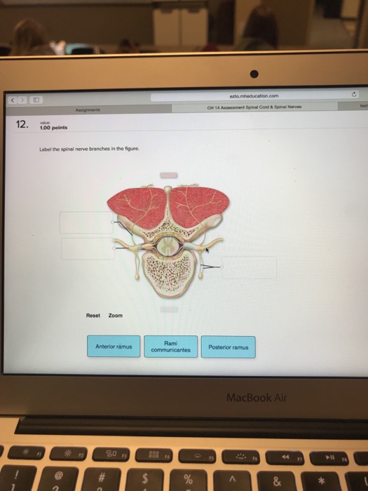 Solved ipinal Conds & Spinal Nerves 12. 100 points Label the | Chegg.com