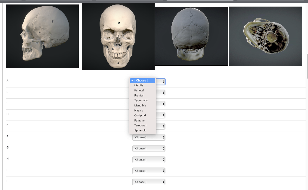 Solved which muscles support the non-working side during | Chegg.com