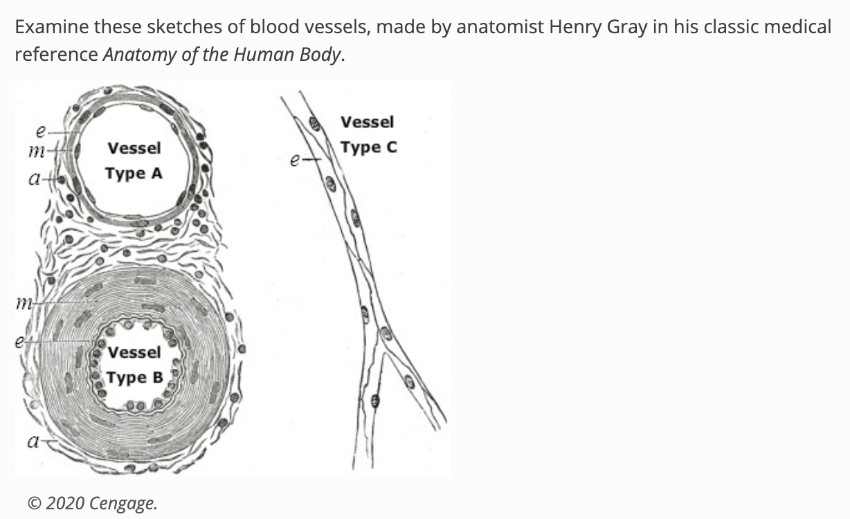 Solved 1. Of the three vessel types pictured, _______ | Chegg.com
