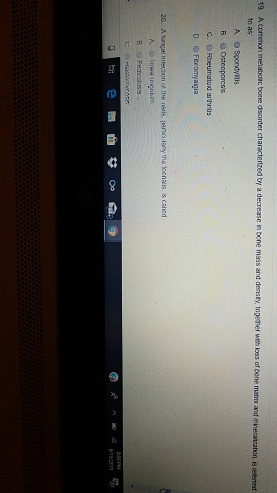 Solved EC demauts may be caused by A OViral infections or a | Chegg.com