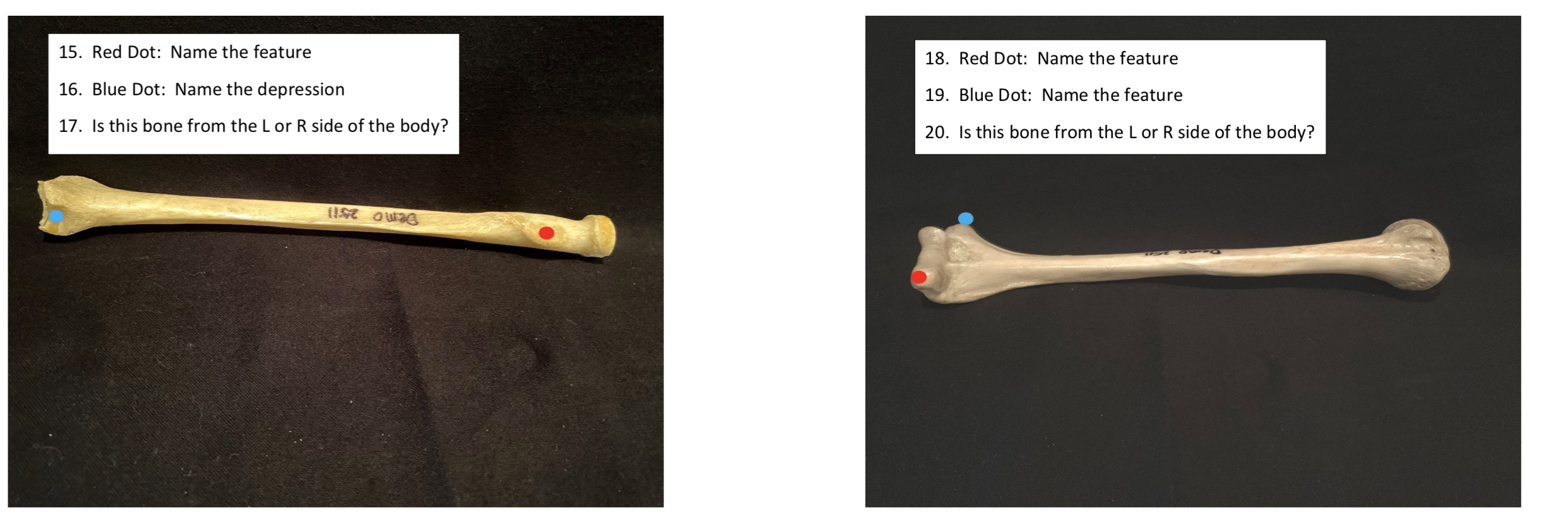Solved 15. Red Dot: Name the feature 18. Red Dot: Name the | Chegg.com