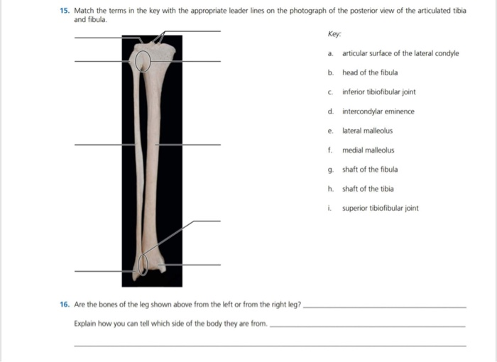 Solved 12. Match the bone names and markings in column B | Chegg.com