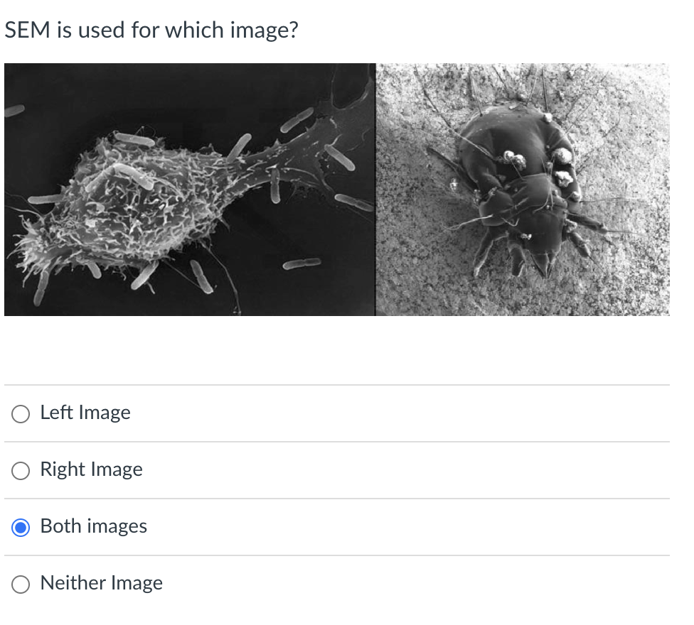 Solved SEM is used for which image?Left ImageRight ImageBoth | Chegg.com