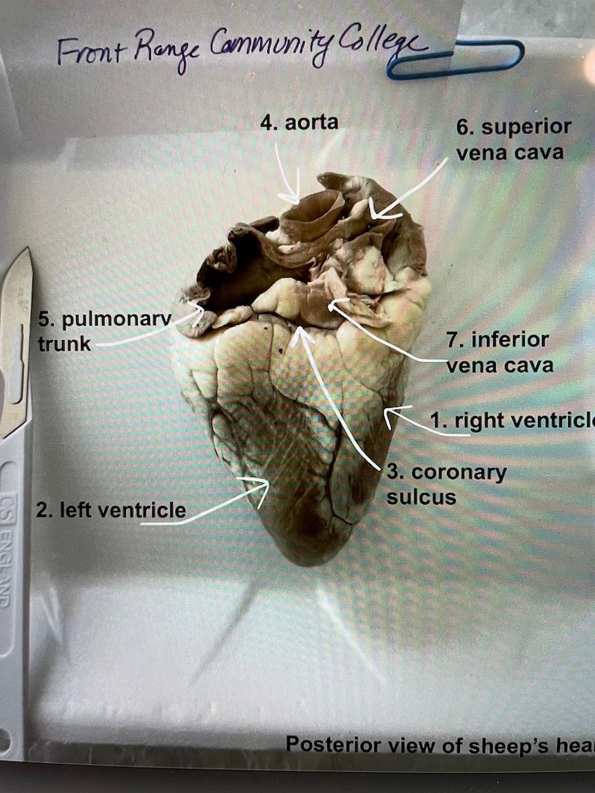 Anterior View Of Sheep Heart Labeled - Home Alqu