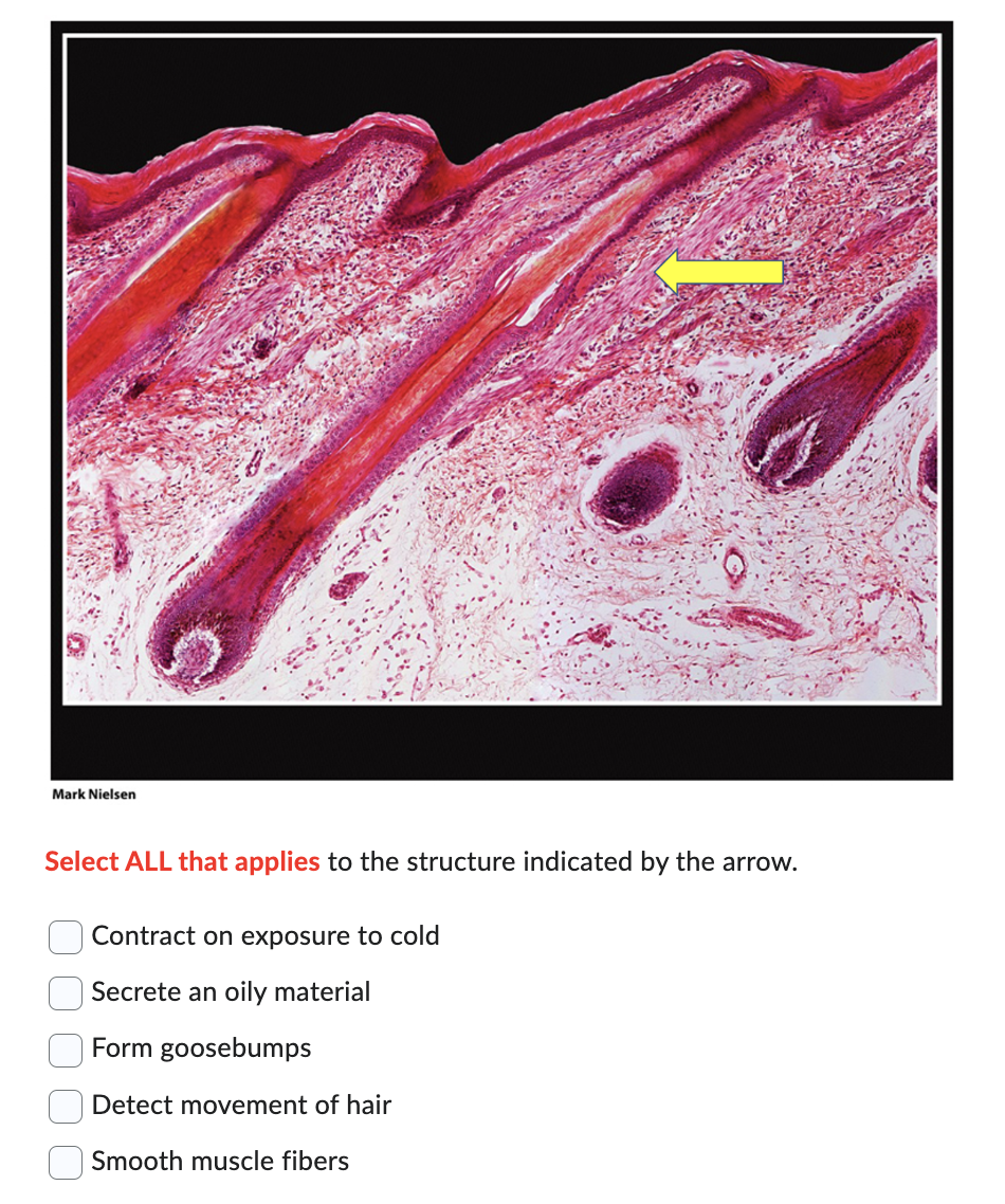 Solved Mark Nielsen Select ALL that applies to the structure | Chegg.com
