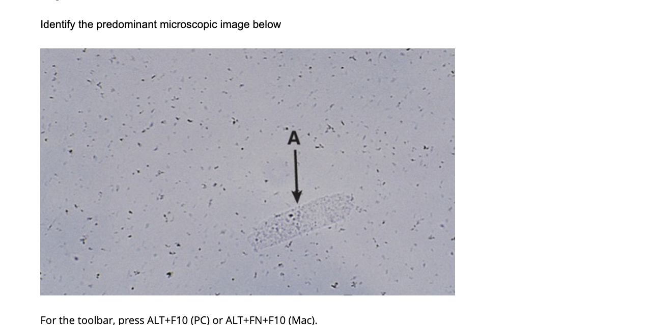 Solved Identify the predominant microscopic image | Chegg.com