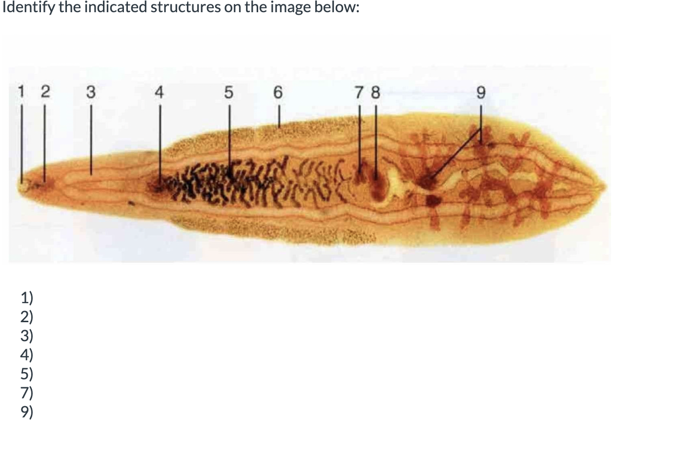 Solved Identify each of the indicated structures in the | Chegg.com Solved Identify each of the indicated structures in the | Chegg.com
