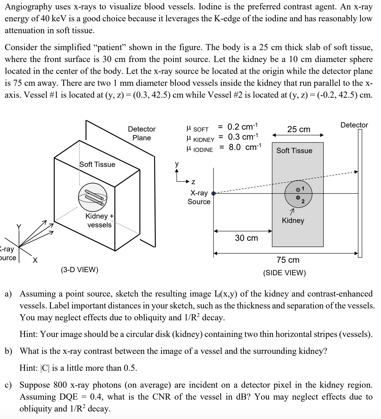 Solved Angiography uses x-rays to visualize blood vessels. | Chegg.com