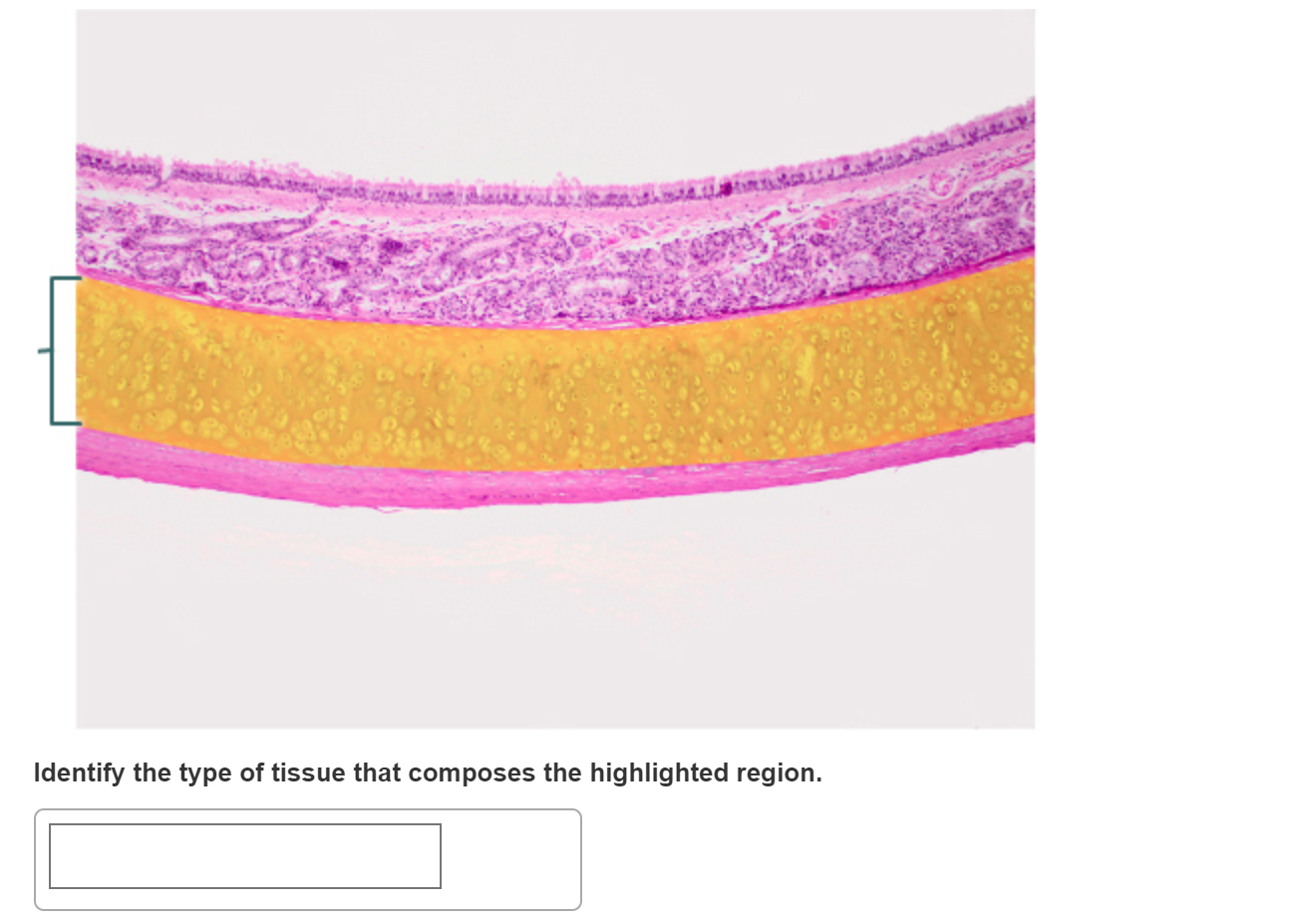 Solved Identify the highlighted structure. Identify the | Chegg.com