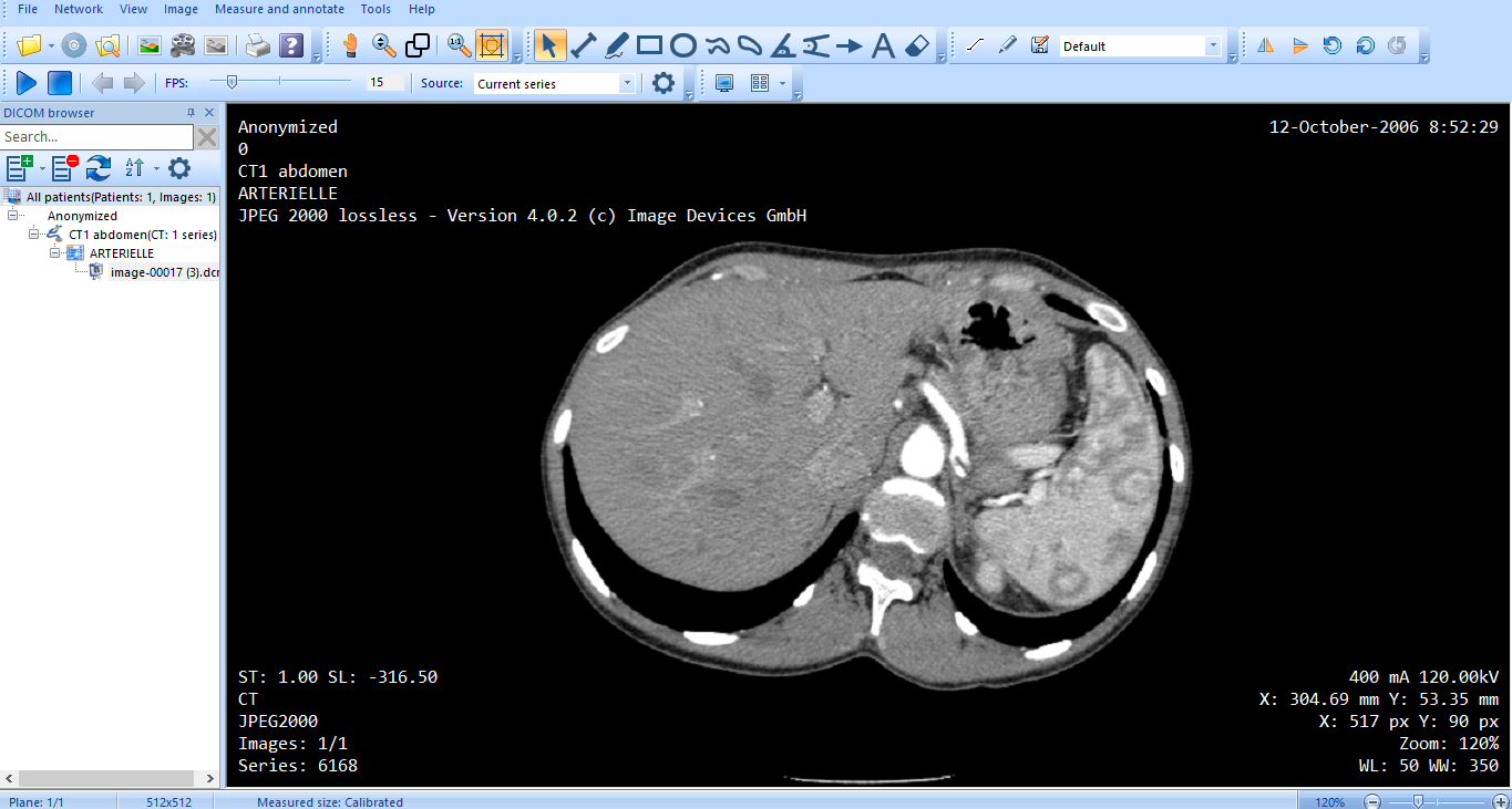 Solved Practical work N4 DICOM images 1. Add a CT image to | Chegg.com