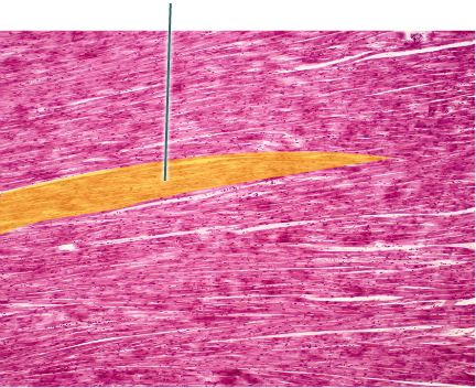 Solved Which structures are highlighted?smooth muscle | Chegg.com