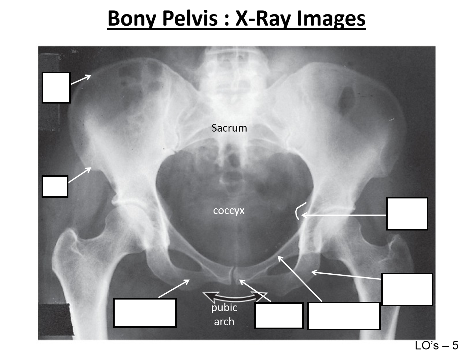 Pelvic Inlet X Ray